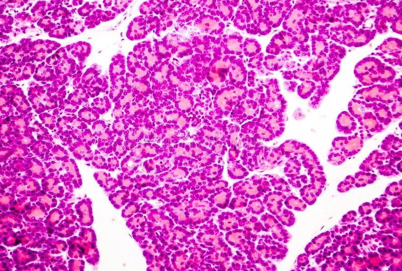 Microscopic Photo Showing Pancreatic Tissue Stock Image - Image of ...