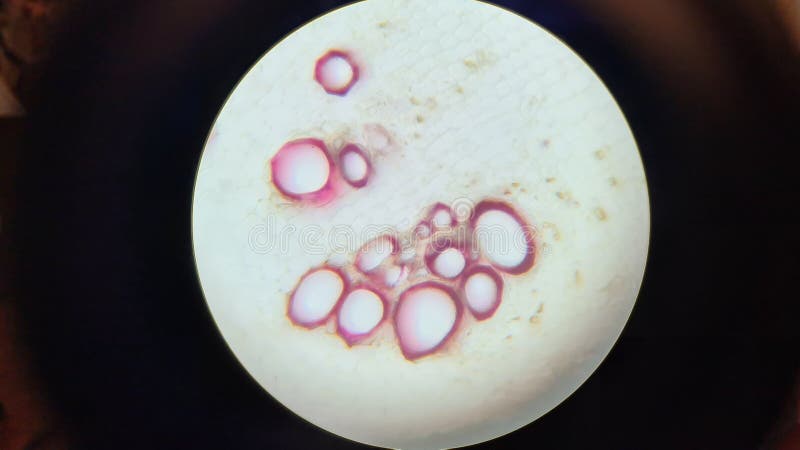 Microscopic Photo of Xylem in Beet Root Permanent Preparation Stock ...