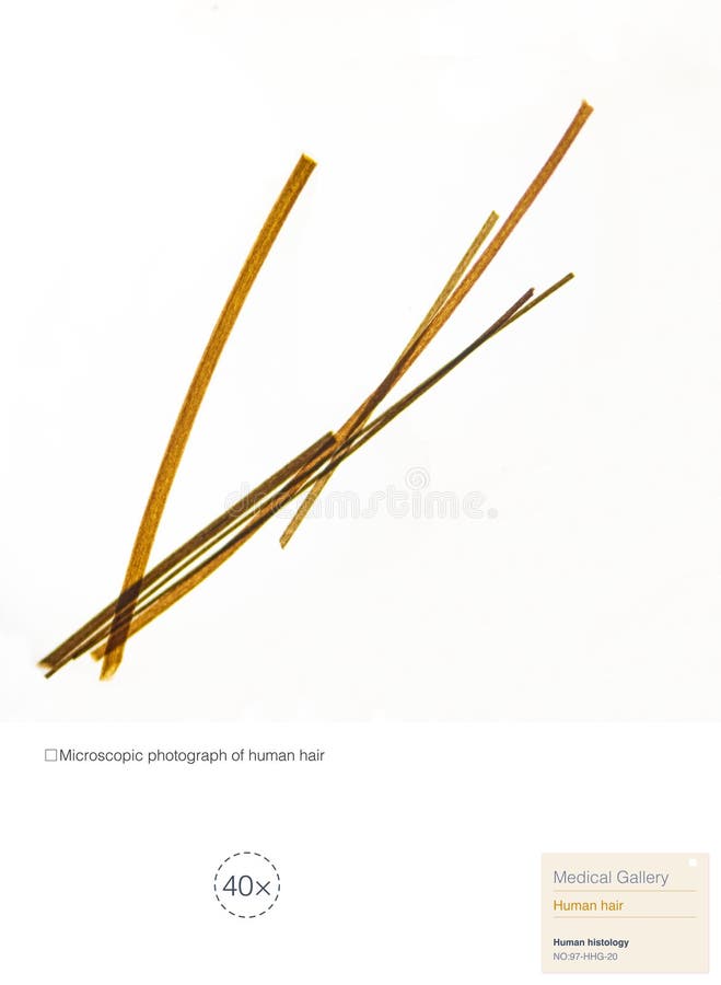 Microscopic Photograph of Human Hair Stock Image - Image of clinical ...