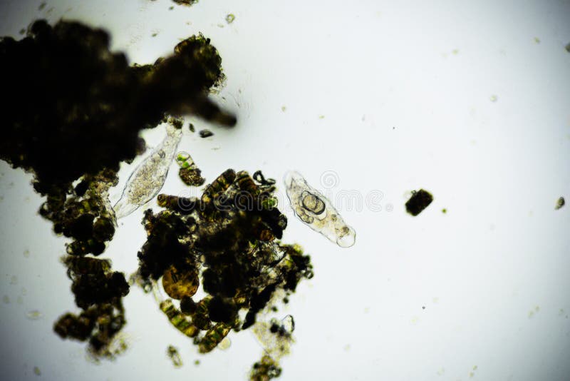 The Rotifer Rotifera, Commonly Called Wheel Animals Under the ...