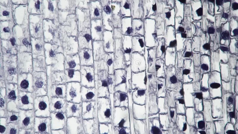 Root Tip of Allium Cepa in Longitudinal Section Magnified by Microscope ...