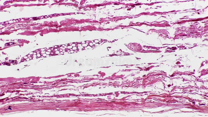 Epidermis Layers Slides