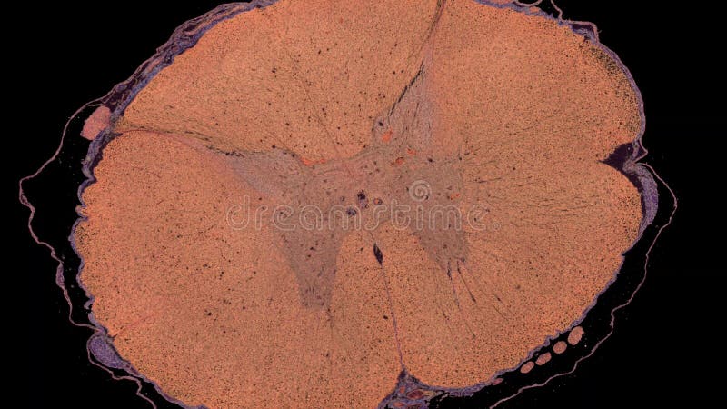 Microscopic View of Corpus Ventriculi in Section Magnified in 40 Times ...