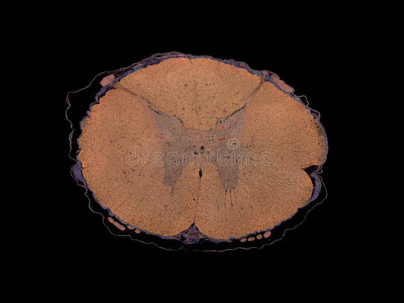 Spinal Cord - Cross Section Cut Under the Microscope â€“ Microscopic ...