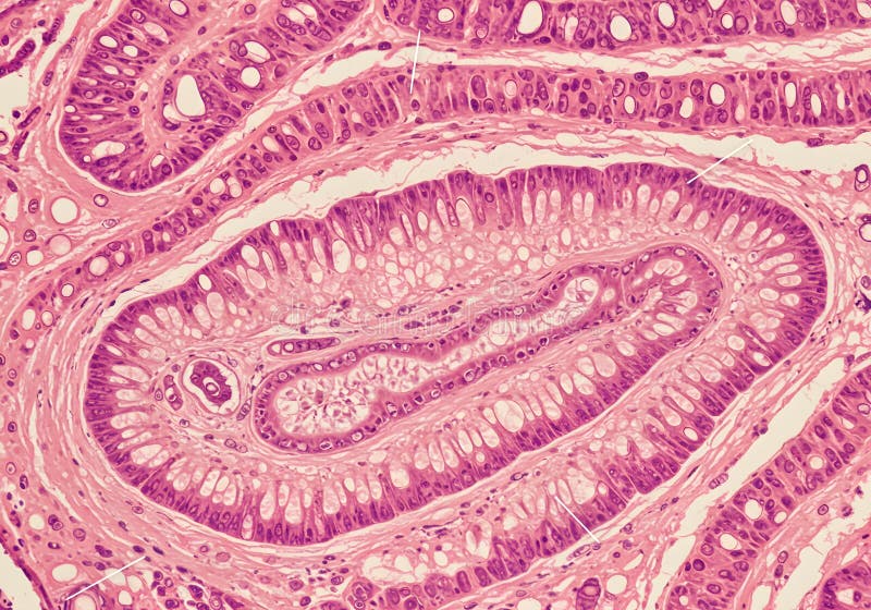 Microscopic Tissue stock image. Image of microscopic - 385536031