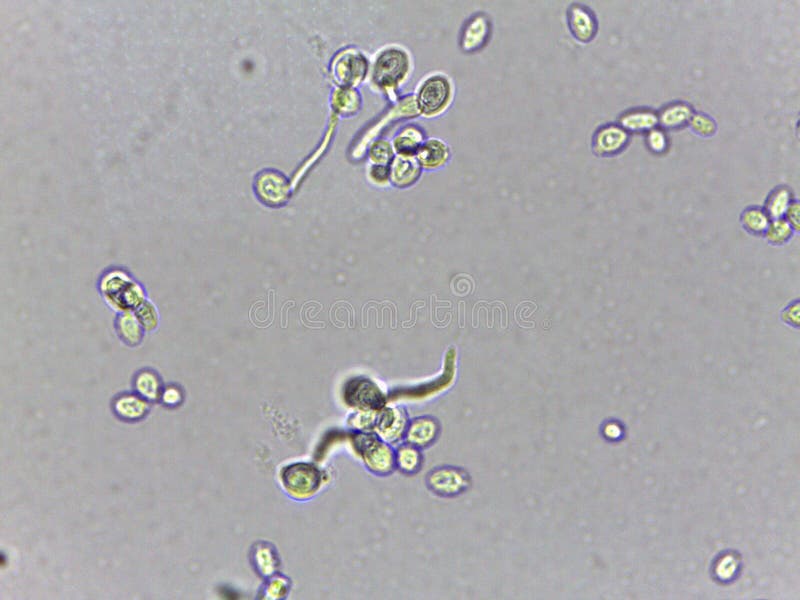 255 Budding Yeast Cells Stock Photos - Free & Royalty-Free Stock Photos ...