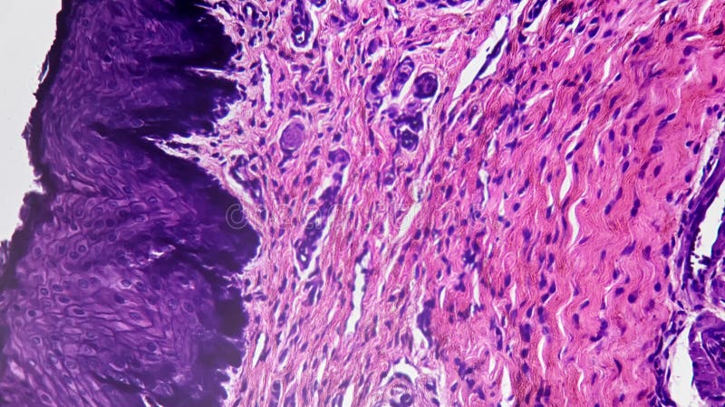 A Microscopic View of a Cross Sectional View of the Human Penis Under ...