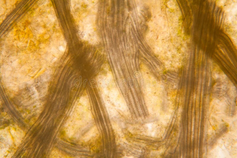 Microscopic View and Details of Rotten Tulip Stem Stock Image - Image ...