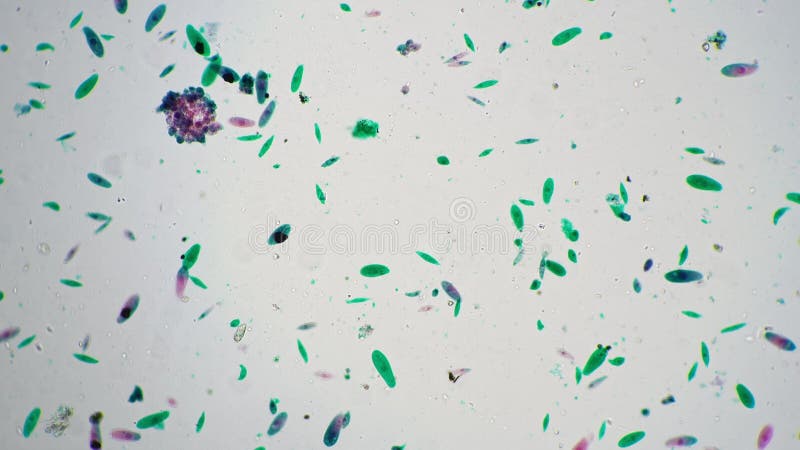 Microscopic View of Euglena 100x on Bright Field Background Stock ...