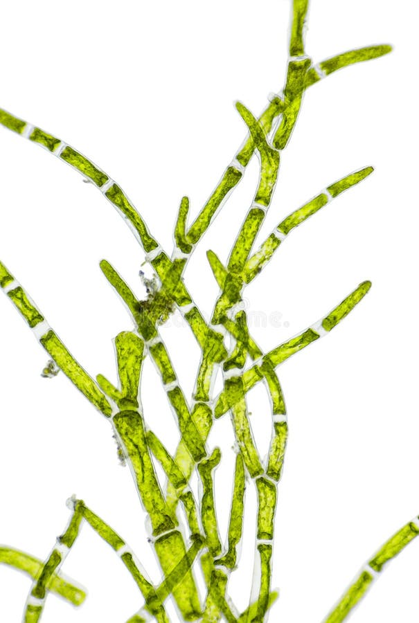Microscopic View of Green Algae (Cladophora) Branch Stock Image - Image ...