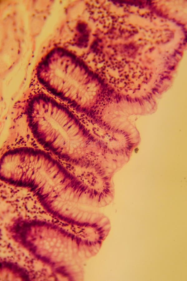 Microscopic View Intestinal Tissue Stock Photos - Free & Royalty-Free ...