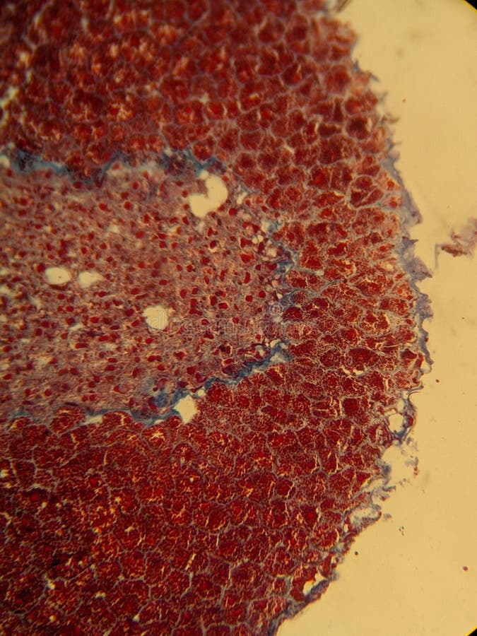 Microscopic View of Liver Tissue Stock Image - Image of research ...