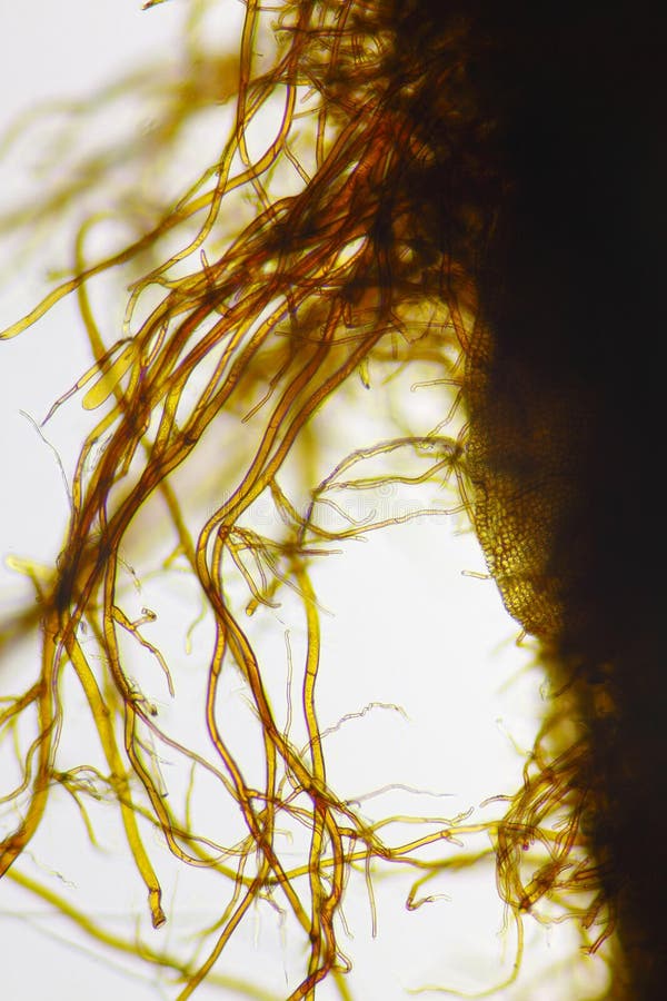 Microscopic View of Moss Rhizoids Stock Photo - Image of organism ...