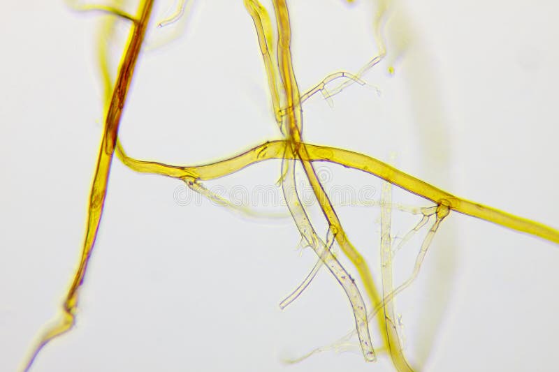 Moss Rhizoids Stock Photos - Free & Royalty-Free Stock Photos from ... Moss Rhizoids Stock Photos - Free & Royalty-Free Stock Photos from ...