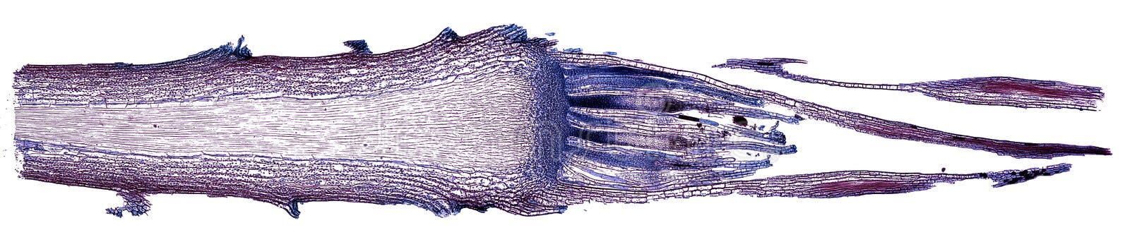 358 Beetroot Under Microscope Stock Photos - Free & Royalty-Free Stock ...