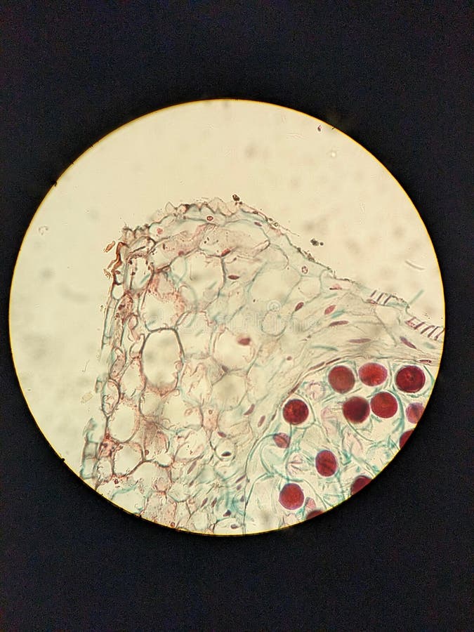 Microscopic View of Plant Tissue with Red-stained Cells. Stock Photo ...