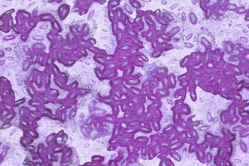 Microscopic View of Purple Bacteria Clusters in a Petri Dish with ...