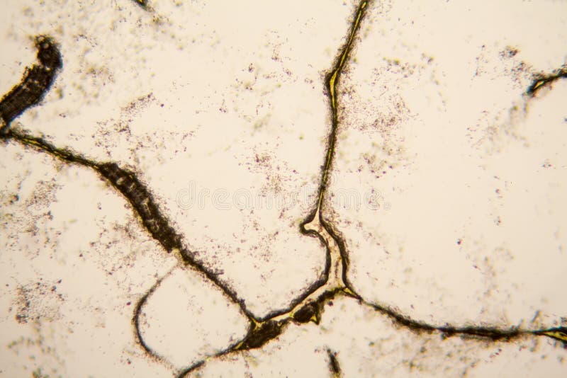 Microscopic View of Rotten Tulip Stem Stock Image - Image of frame ...