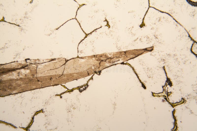 Microscopic View of Rotten Tulip Stem Stock Image - Image of nature ...