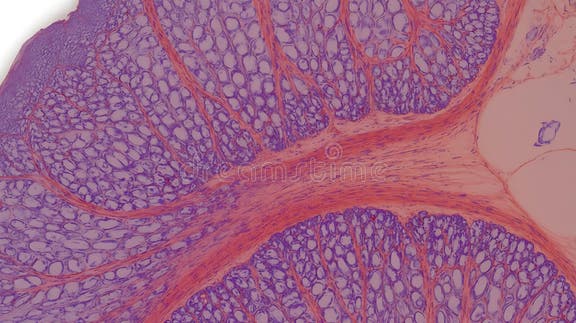 Microscopic View Showing Cells with Staining in Pinks Purples and Reds ...