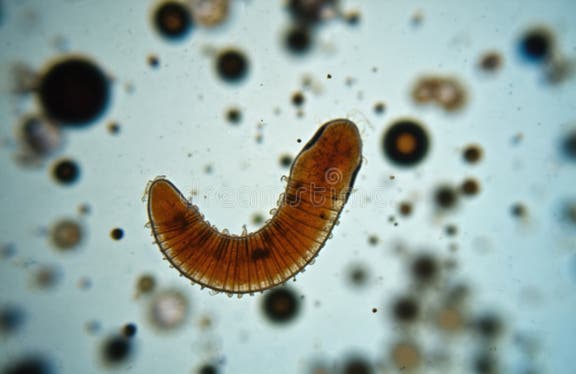 Microscopic View of Soil Microorganisms, Including Nematode ...