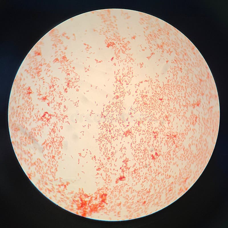 Microscopic View of Stained Bacteria Stock Photo - Image of ...