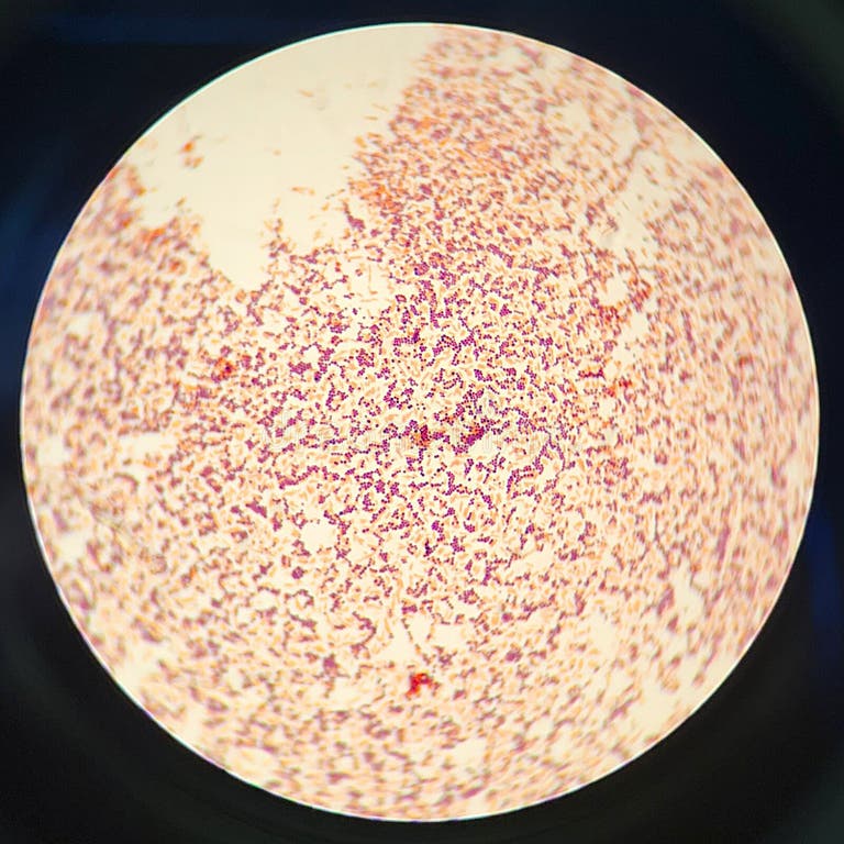 Microscopic View of Stained Bacteria Stock Image - Image of cells ...