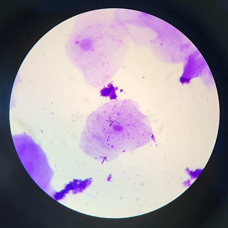 Microscopic View of Stained Cells Stock Image - Image of medical ...
