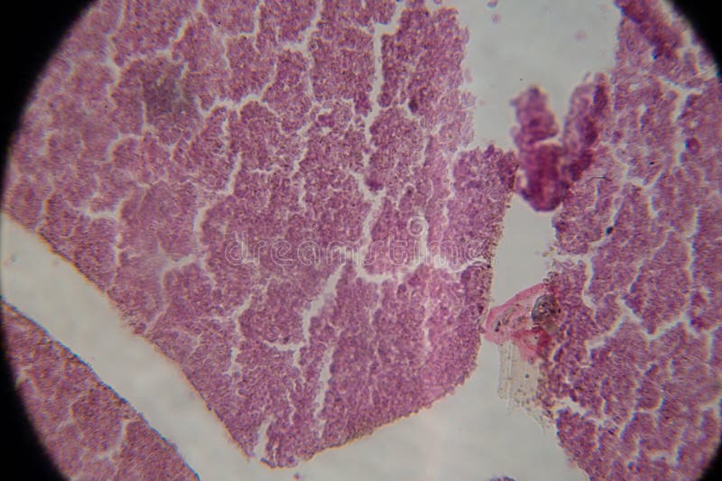 Microscopic View of Stained Tissue Sample Stock Photo - Image of ...