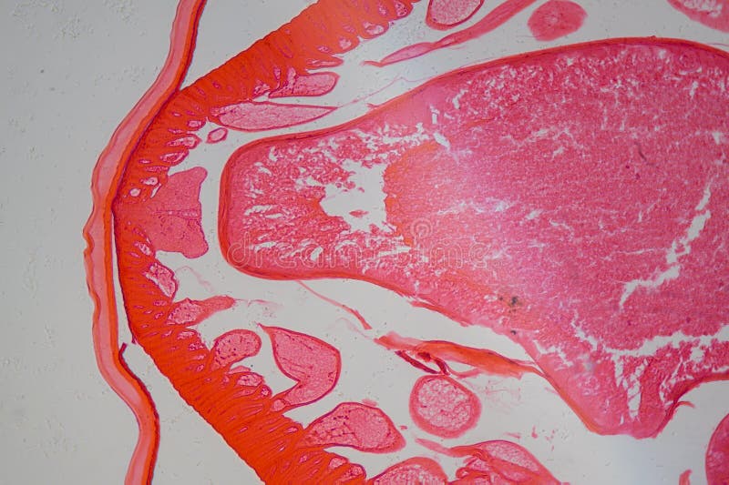 Microscopic View of Stained Tissue Sample Stock Photo - Image of ...