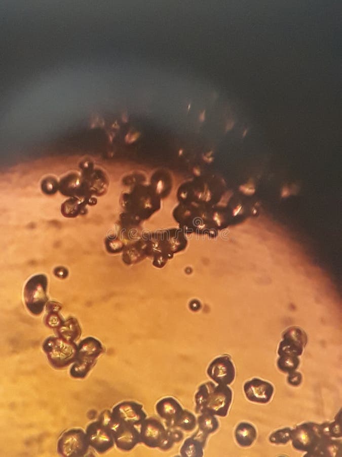 Starch Granules Viewed Under Light Microscope Stock Image - Image of ...