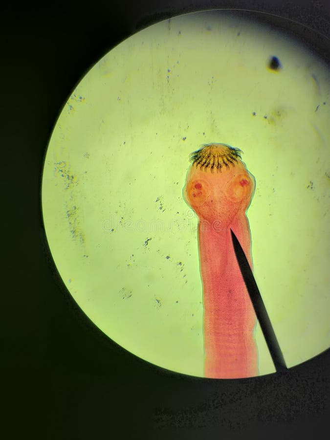 Microscopic View of Tapeworm Stock Image - Image of glass, medical ...