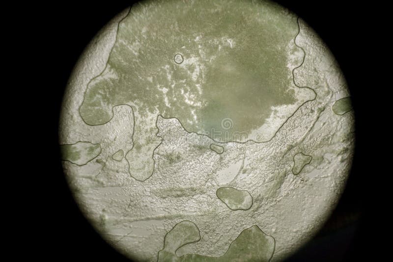 Microscopic view stock image. Image of view, magnification - 82908327