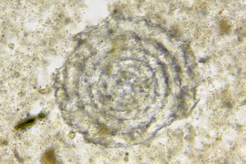 Microscopic View of Unspecified Marine Microfossil Extracted from ...