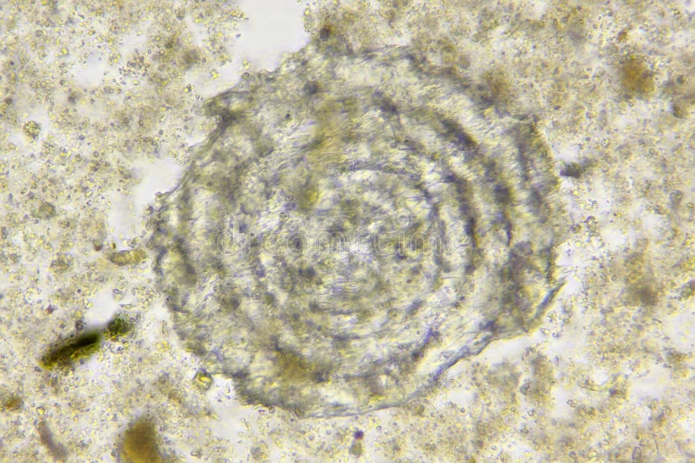 Microscopic View of Unspecified Marine Microfossil Extracted from ...