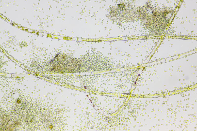 Microscopic View of Various Species of Freshwater Algae Stock Photo ...
