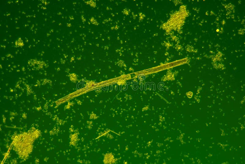 Microscopic View of Various Species of Planktonic Freshwater Algae ...