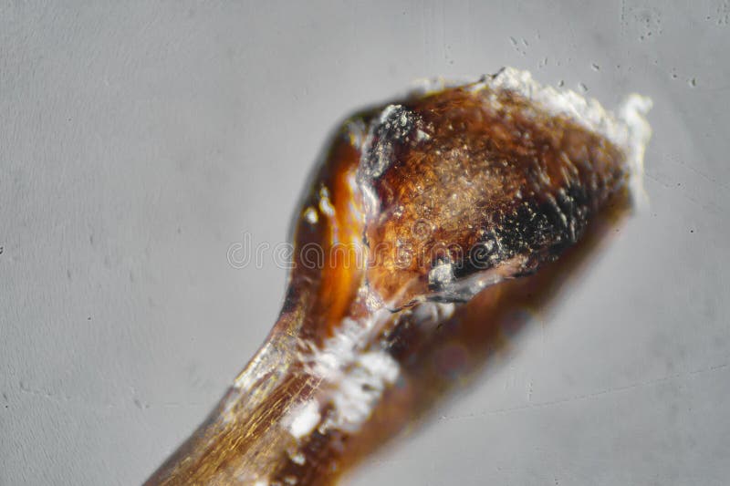 Human hair root stock photo. Image of cytology, analysis - 261465824