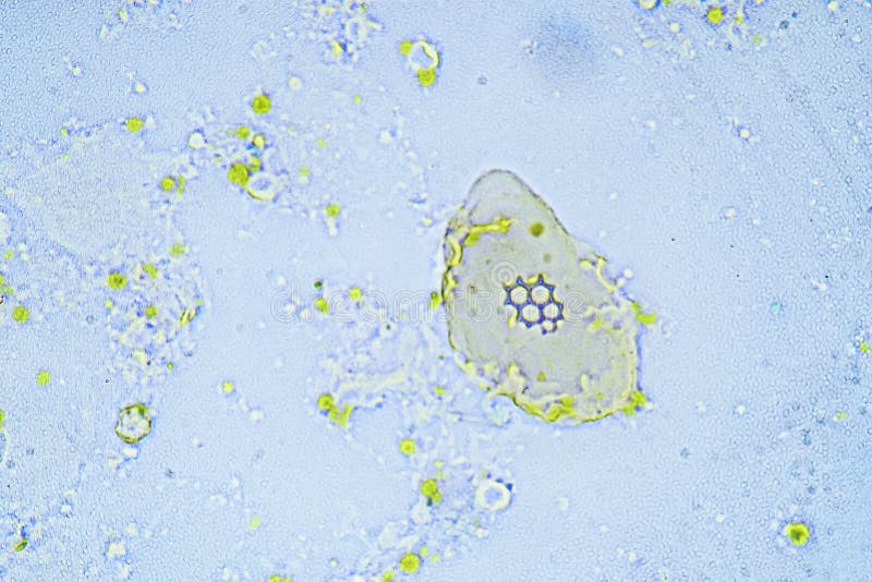 Algae under a microscope. stock image. Image of micro - 113554695