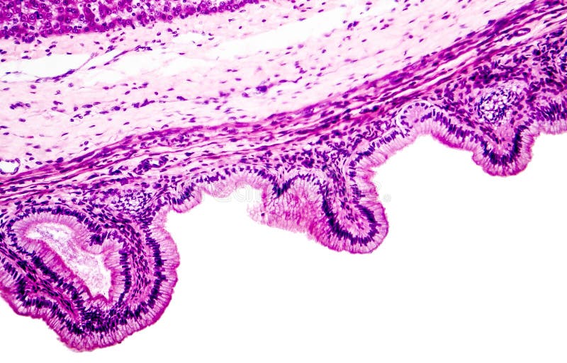 Microscopisch Beeld Die Epithelium Van Urineblaas Tonen Stock ...