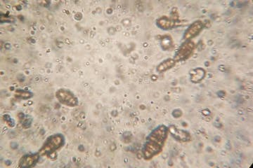 Microscopy of the Alternaria Fungus Macroconidia Stock Photo - Image of ...