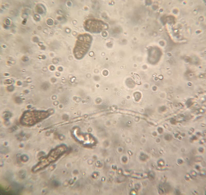 Microscopy of the Alternaria Fungus Macroconidia Stock Photo - Image of ...