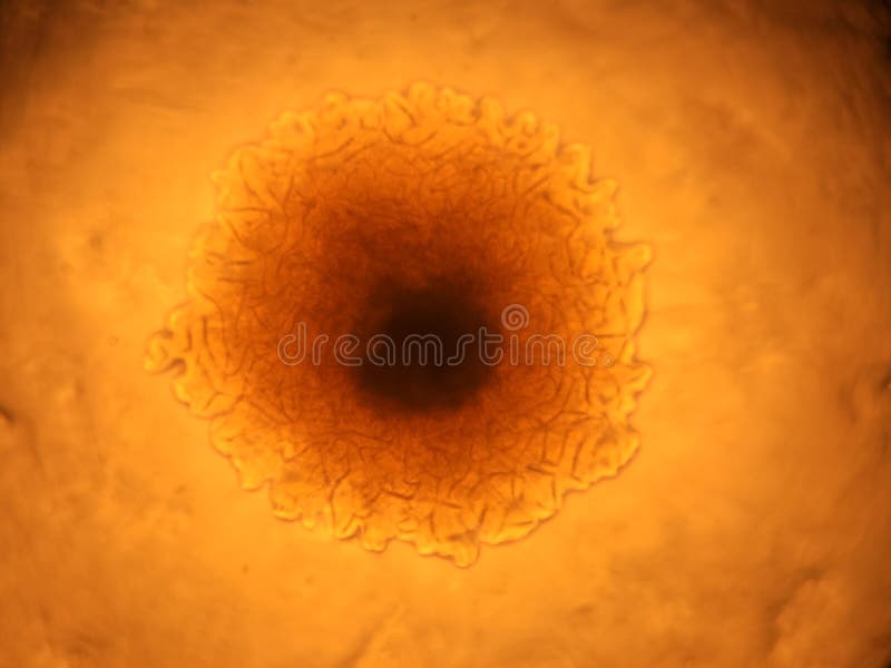 Microscopy of a Bacterial Colony Stock Image - Image of bacterial ...