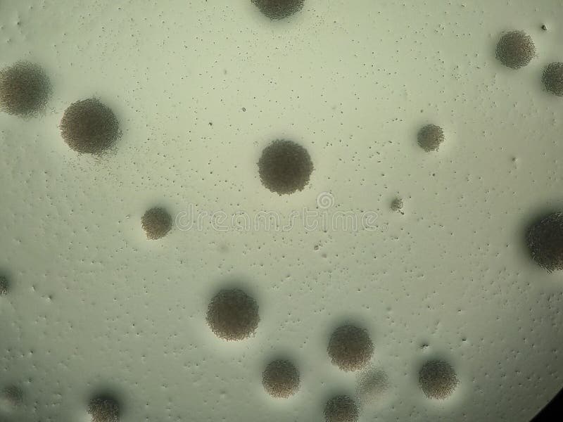 Microscopy of Candida Albicans Colonies Stock Image - Image of nutrient ...