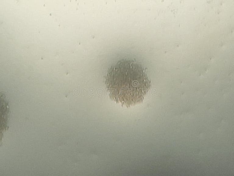 Candida Albicans and Colony Under the Microscope Stock Photo - Image of ...