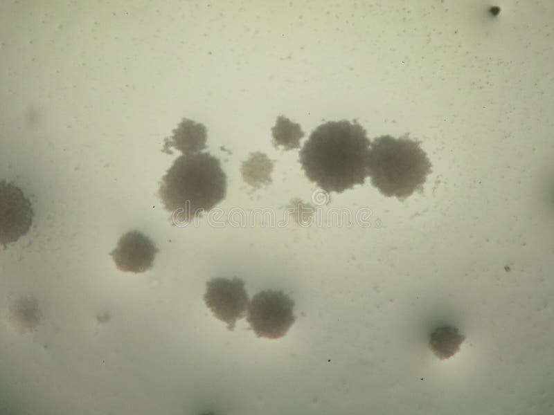 Round Shaped Candida Albicans Colonies Under the Microscope Stock Photo ...