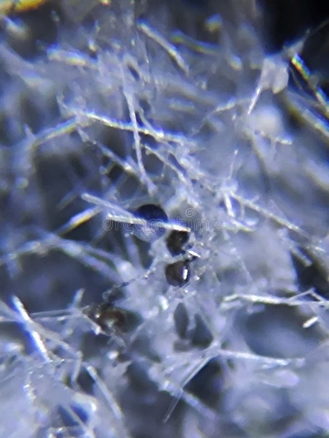 Aspergillus Genus Mold Under the Microscope Stock Image - Image of ...