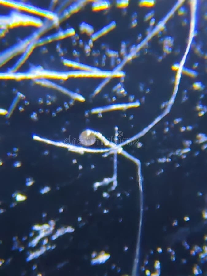 Aspergillus Genus Mold Under the Microscope Stock Photo - Image of ...