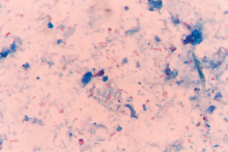 Parasites au microscope image stock. Image du microscope - 98581281