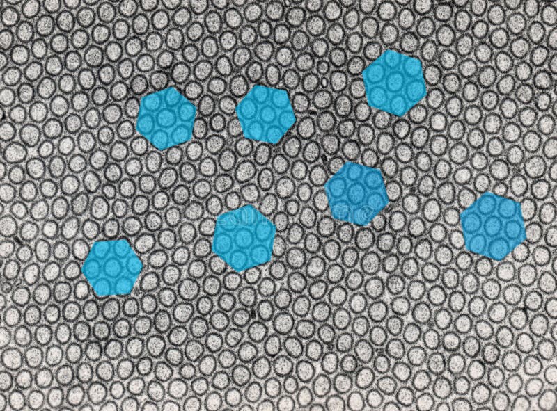 Microvilli. Brush border stock image. Image of brush - 230452609